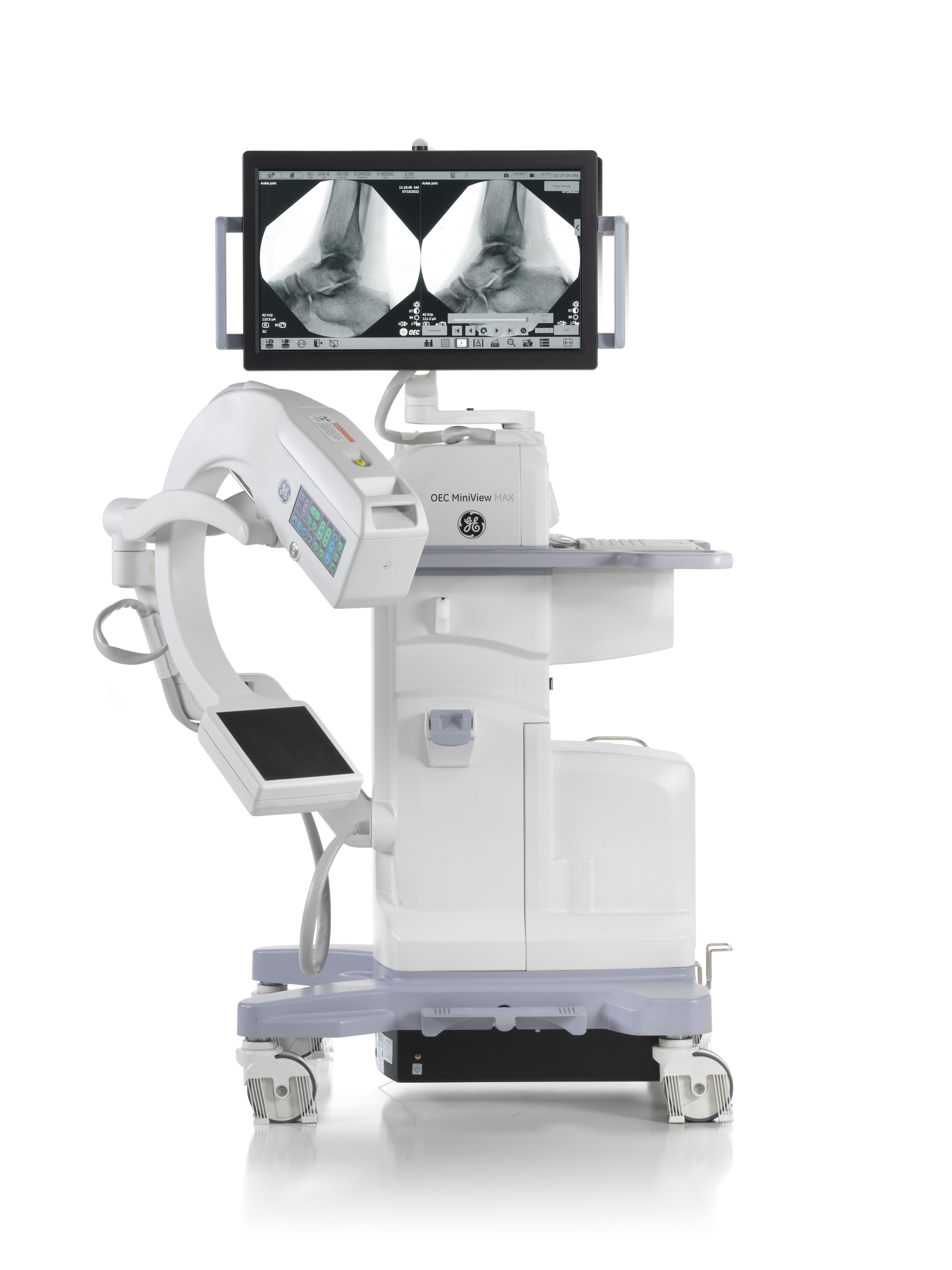 OEC MiniView MAX | GE HealthCare (France)