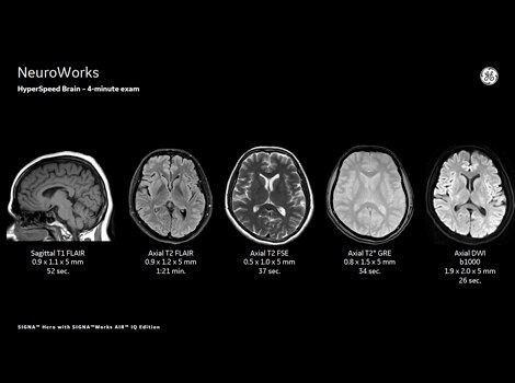 SIGNA™ Hero | GE Healthcare (France)