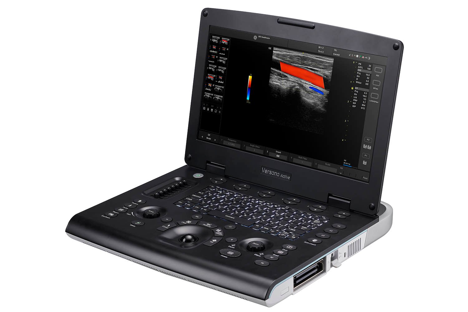 Versana Active | GE HealthCare (France)